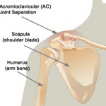 Acromioclavicular (AC) Joint Injury Treatment Des Plaines | Shoulder ...