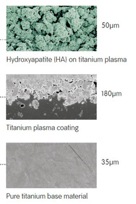 Direct Anterior & Polarstem Active Hip SolutionAndrew R. Noble, MD ...