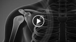 Shoulder PT Protocols
