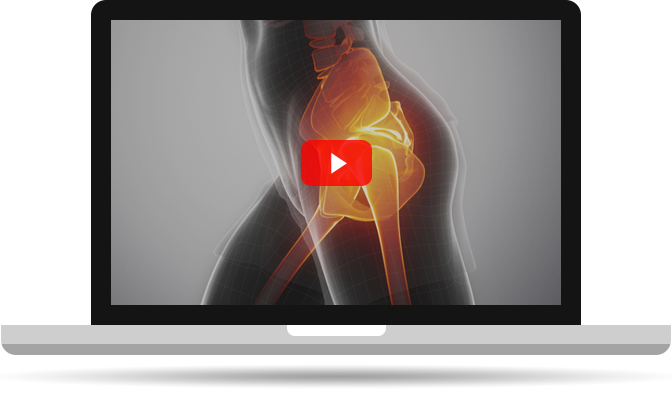 Dr. Christian Eccles | Orthopedic Surgeon Chandler | Hip Replacement ...