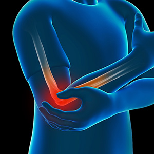 Elbow Injuries Columbia | Elbow Fractures Columbia | Tennis Elbow Columbia