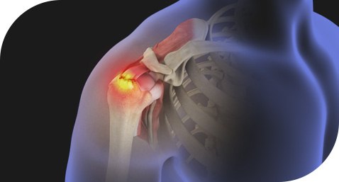 Dr Anup Shah | Sports Medicine Surgeon Phoenix, AZ | Knee Arthroscopy ...