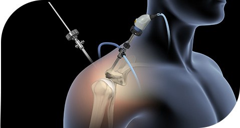 Dr Anup Shah | Sports Medicine Surgeon Phoenix, AZ | Knee Arthroscopy ...