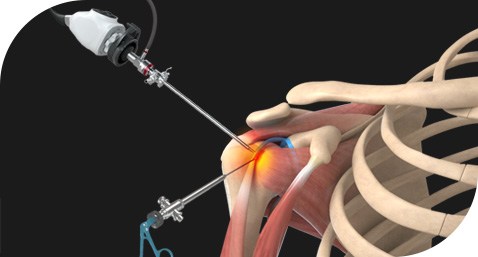 Dr Anup Shah | Sports Medicine Surgeon Phoenix, AZ | Knee Arthroscopy ...