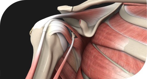 Dr Anup Shah | Sports Medicine Surgeon Phoenix, AZ | Knee Arthroscopy ...