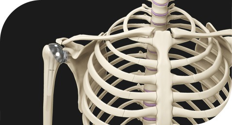 Dr Anup Shah | Sports Medicine Surgeon Phoenix, AZ | Knee Arthroscopy ...