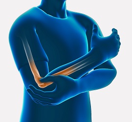 Post-traumatic Stiffness (Elbow) | Advanced Orthopaedics & Sports ...