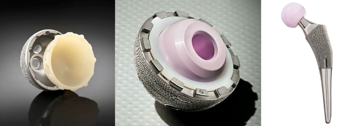 Total Hip Replacement | Orthopedic Surgeon | Joint Replacement Overland ...