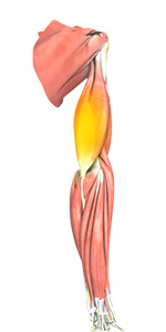 Triceps Tendonitis Treatment Lincoln NE | Distal Triceps Tendon Repair ...