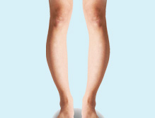 Deformity Correction | Paul Thomas Freudigman, M.D.