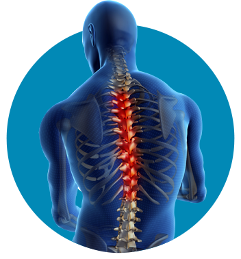 Minimally Invasive Spine Surgery Waxahachie TX | Spine Surgeon Mansfield TX