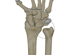 What Are Distal Joints Distal Phalanx: Definition, Location, Anatomy,