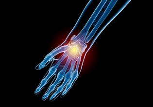 Hand Injuries and Conditions Dr. Taylor Jobe