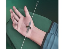 Fracture Care by Dr. Taylor Jobe