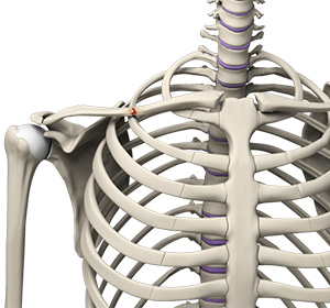 Clavicle Fracture Surgery Conway SC | Scapula Fracture Treatment Horry ...