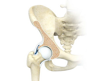 Orthopedic Hip Surgeon Conway SC | Horry County Hip Surgery, Myrtle ...