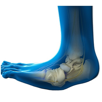 Foot Pain Weatherford TX | Ankle Trauma | Ankle Arthritis Fort Worth TX