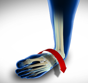 Ankle Instability Lewisburg, WV | Foot & Ankle Surgeon Ronceverte, WV