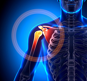 Shoulder Disorders | Erik Stapleton D.O., M.S., Board Certified ...