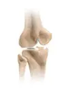 Post-operative Rehabilitation Protocol | Cartilage Repair St. Louis, MO