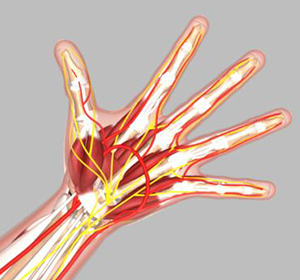 Hand Treatment Centre Ventura, Camarillo, CA | Ulnar Nerve Pain Oxnard, CA