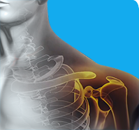 Shoulder Impingement Birmingham | Frozen Shoulder | Shoulder ...