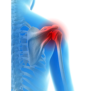 Baseball Injuries Baltimore | Shoulder Injuries Bel Air MD