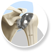 Dr Daniel Acevedo | Orthopedic Surgeon Tarzana, CA | Elbow Surgeon ...