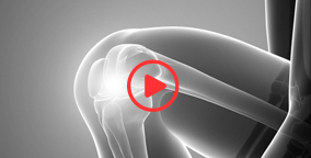 VELYS Robotic-Assisted Solution For Knee Replacement Fresno CA ...