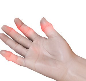 Finger Sprain South Jordan | Finger Injury Treatment Salt Lake City ...