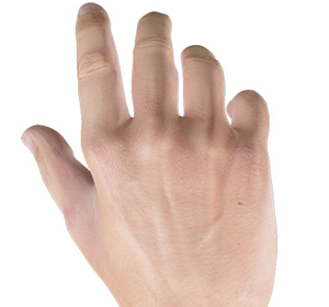 Hand Therapy Salt Lake City | Hand Surgeons Utah | Hand Injury South Jordan