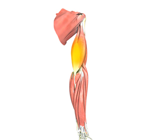 Triceps Tendonitis Salt Lake City | Tendon Repair South Jordan, Farmington