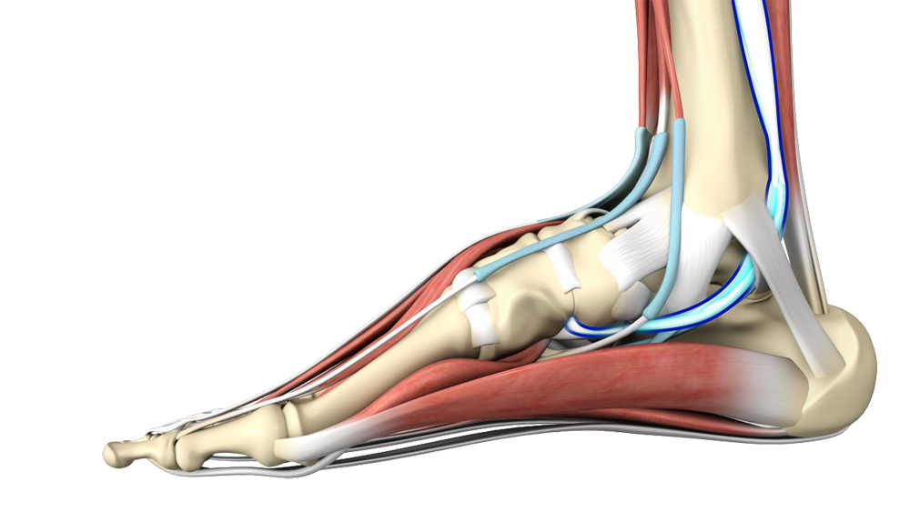 Posterior Tibial Tendon Dysfunction Abingdon, VA | Tenosynovectomy ...