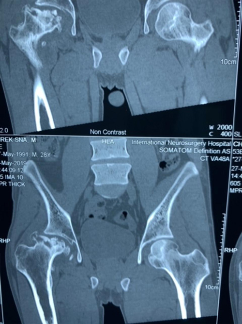 Cambodia Mission Trip | Dr Ian Weber | Orthopaedic Surgeon Denver