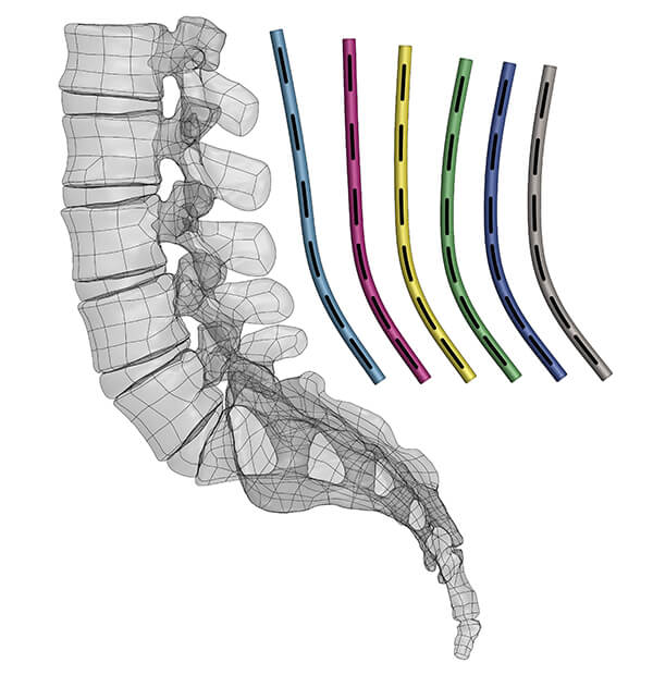 PI-Rods Wilmington, NC | Spinal Alignment Solutions Wilmington, NC