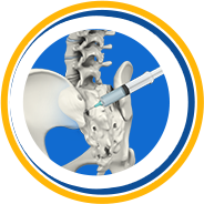 Hip Pain Treatment Orland Park IL | Sacroiliac Joint Injections Cook County