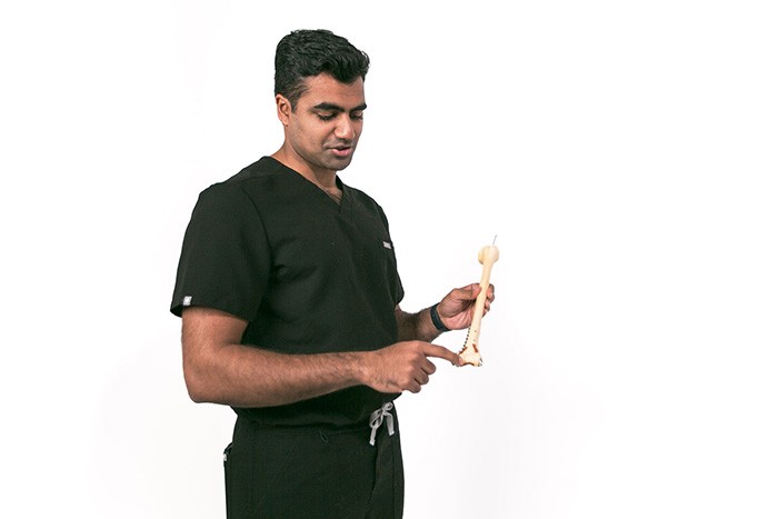 Distal Humerus Fractures of the Elbow Los Angeles | Elbow Specialist ...