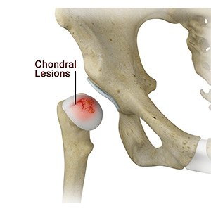 Hip Conditions | Elite Ortho Sport Spine, Orthopaedic Surgeon Manchester