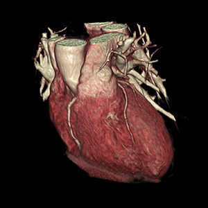 MRI Chester | CT Scan | Musculoskeletal Ultrasound Greater Manchester