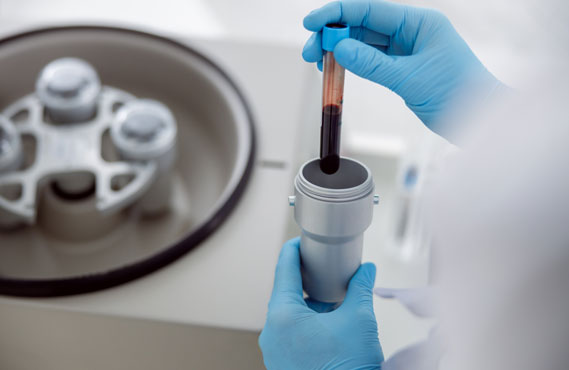 Sports Medicine Houston | Regenerative Medicine Houston TX